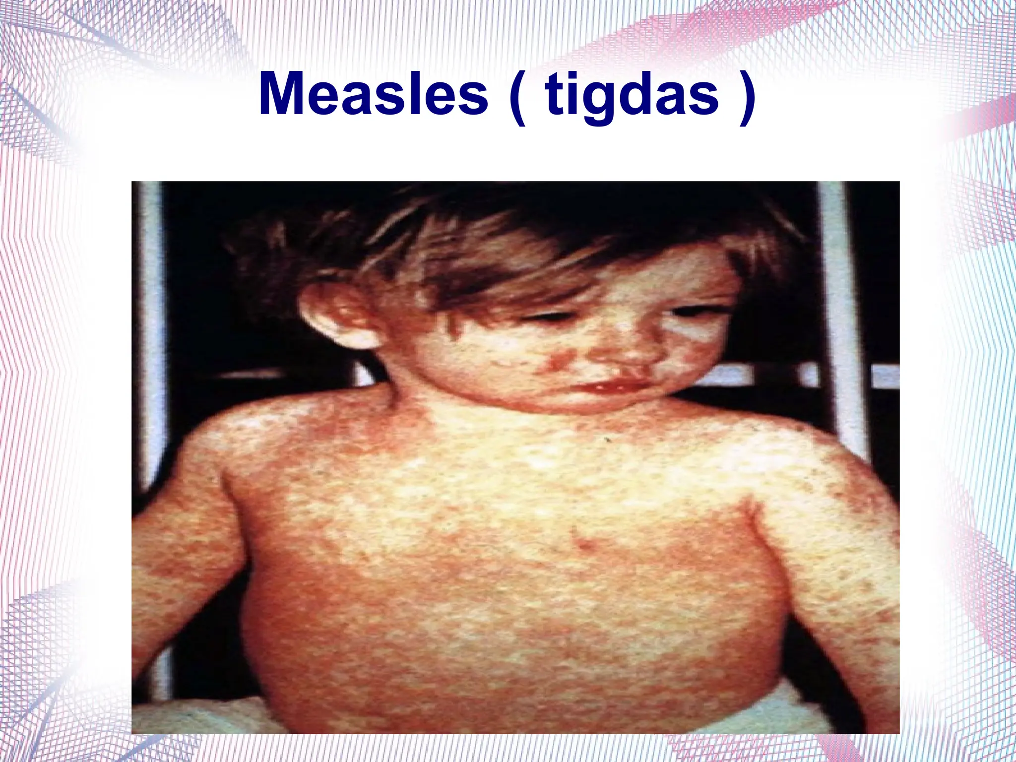 School-Based-Immunization-Program.pptx