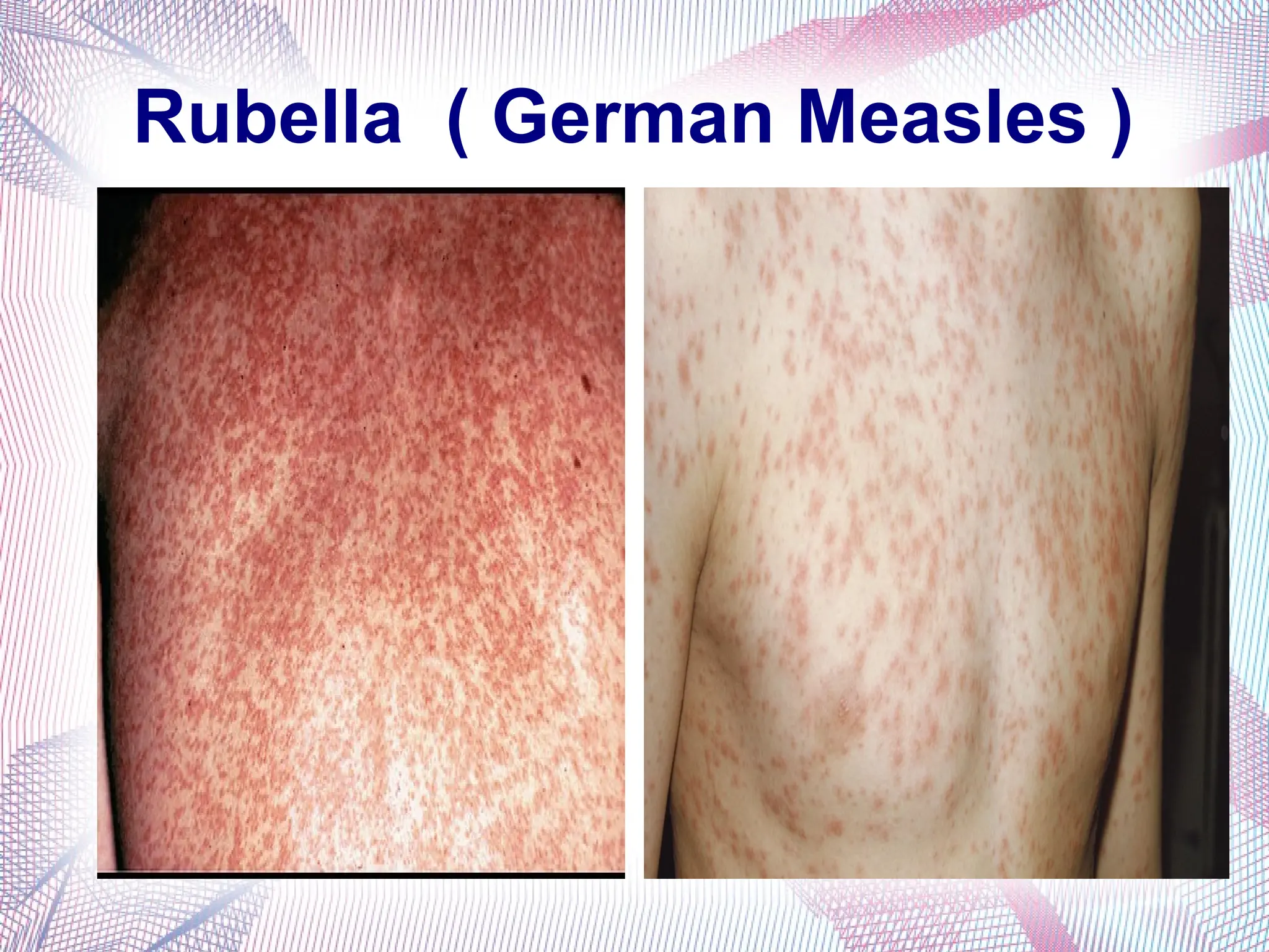 School-Based-Immunization-Program.pptx