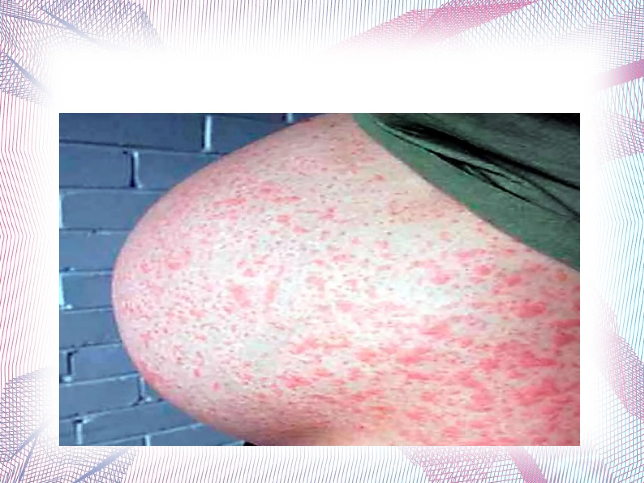 School-Based-Immunization-Program.pptx