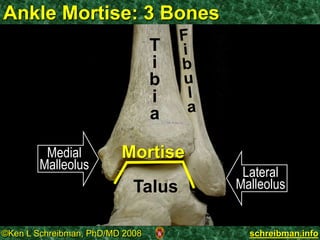 Ankle twisting injuries MSK Radiology | PPSX