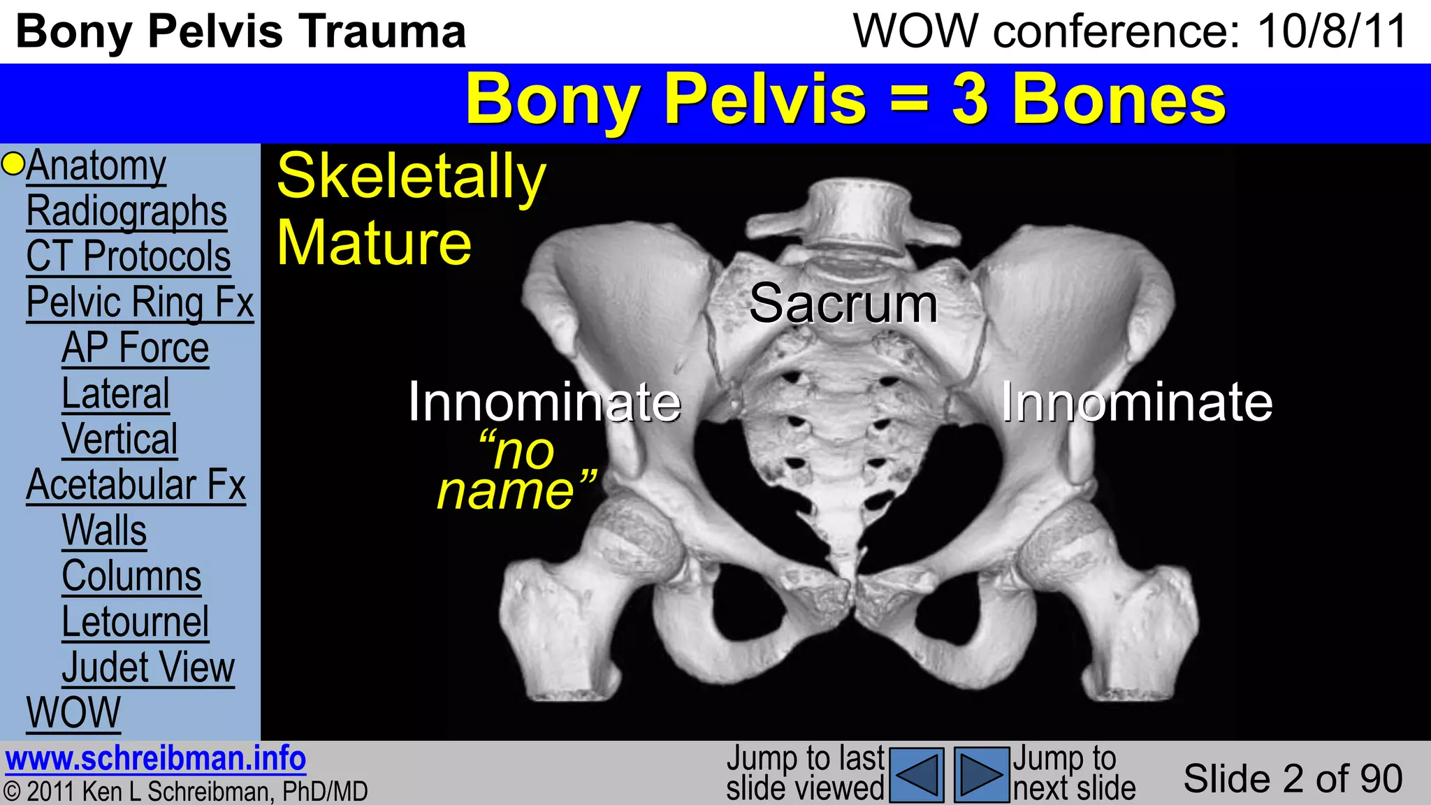 Bony Pelvis Trauma MSK Radiology Lecture | PPSX