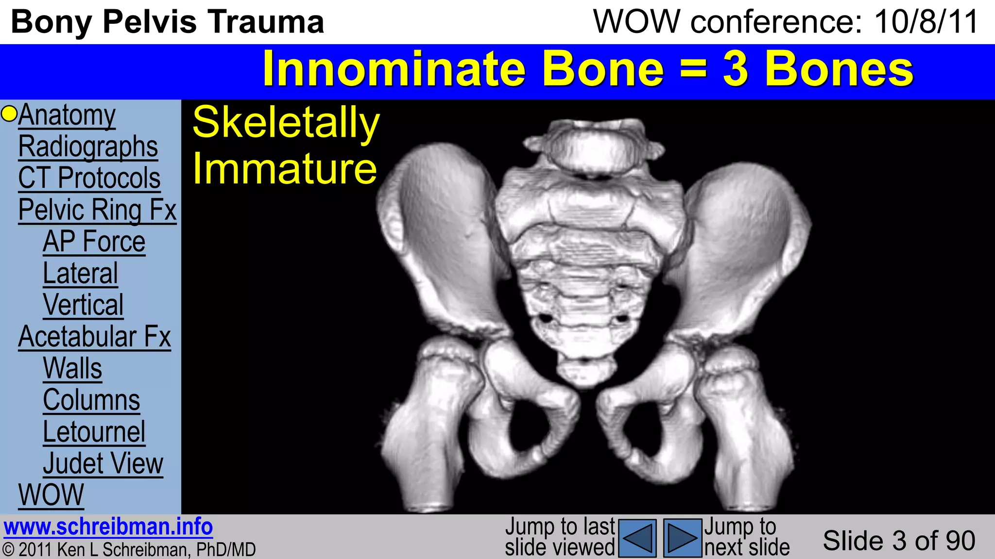 Bony Pelvis Trauma MSK Radiology Lecture | PPSX