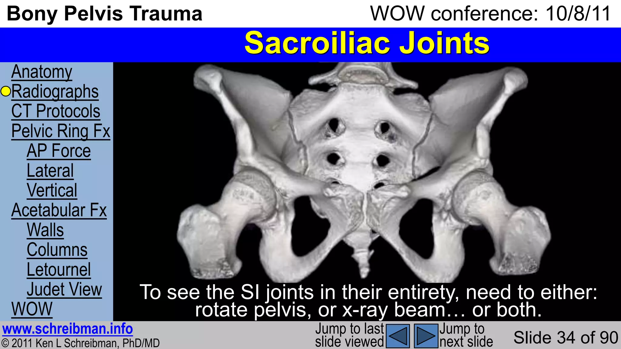 Bony Pelvis Trauma MSK Radiology Lecture | PPSX