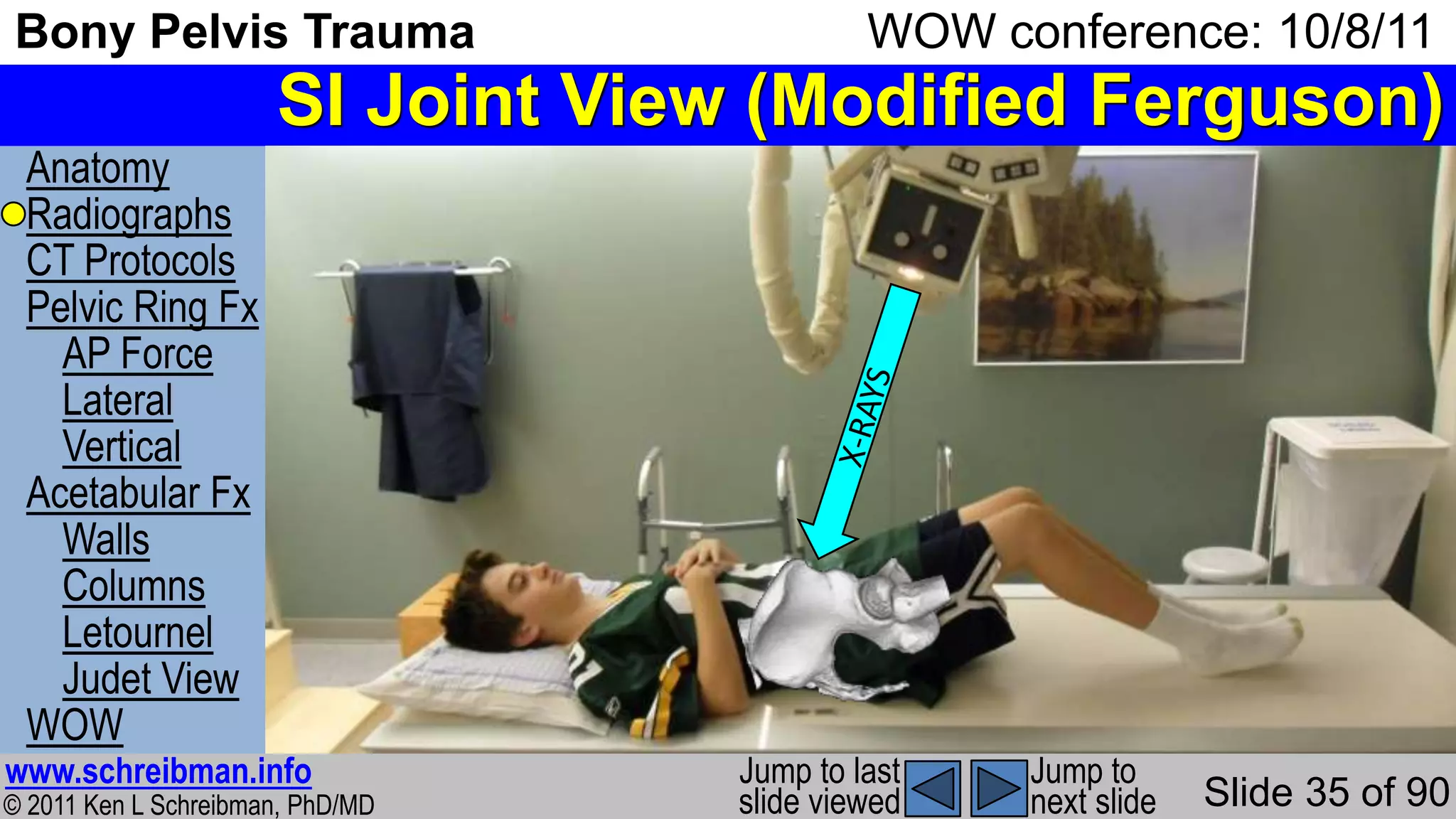 Bony Pelvis Trauma MSK Radiology Lecture | PPSX