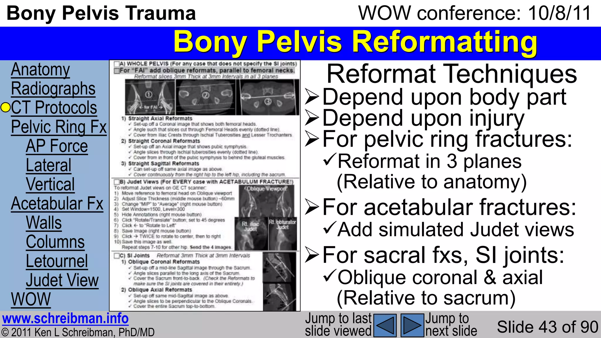 Bony Pelvis Trauma MSK Radiology Lecture | PPSX