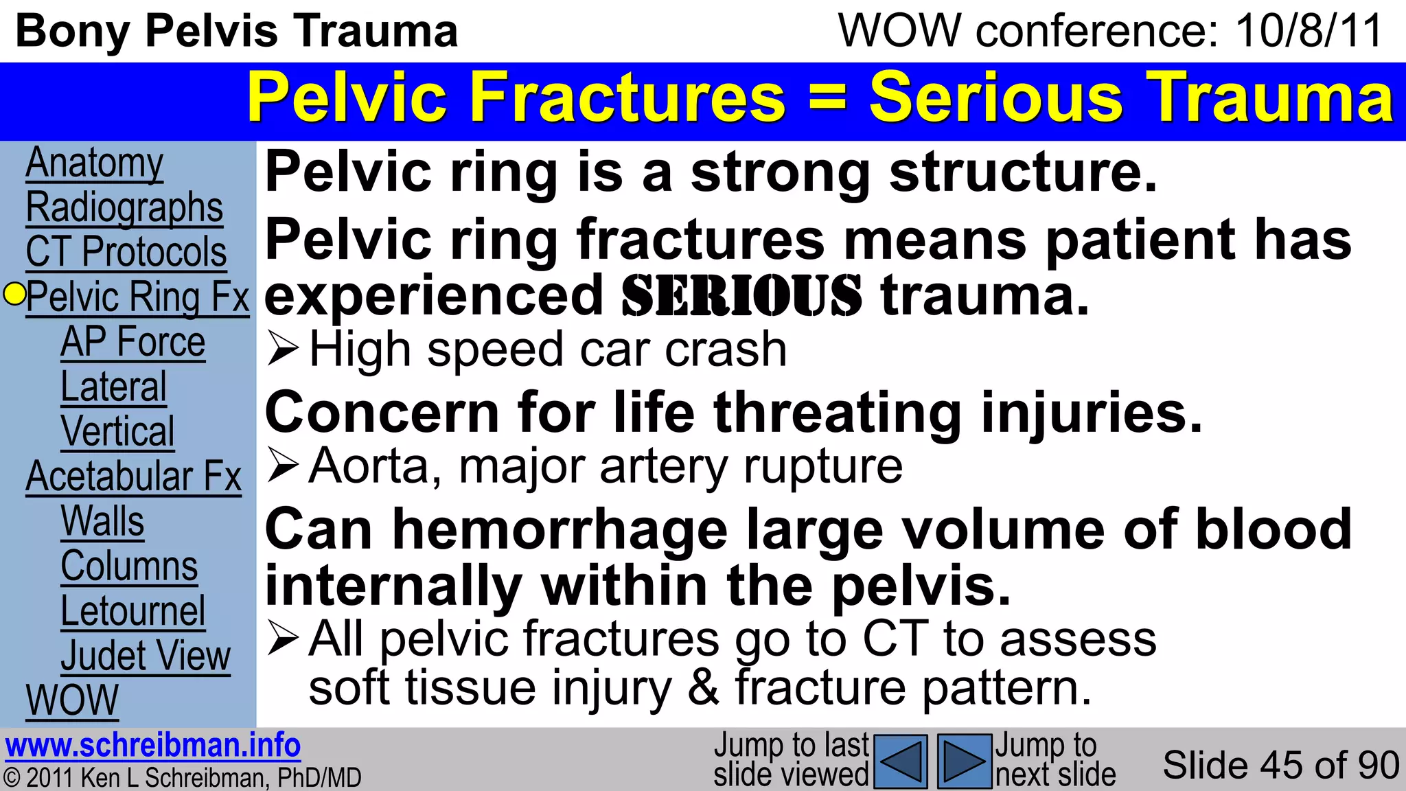 Bony Pelvis Trauma MSK Radiology Lecture | PPSX