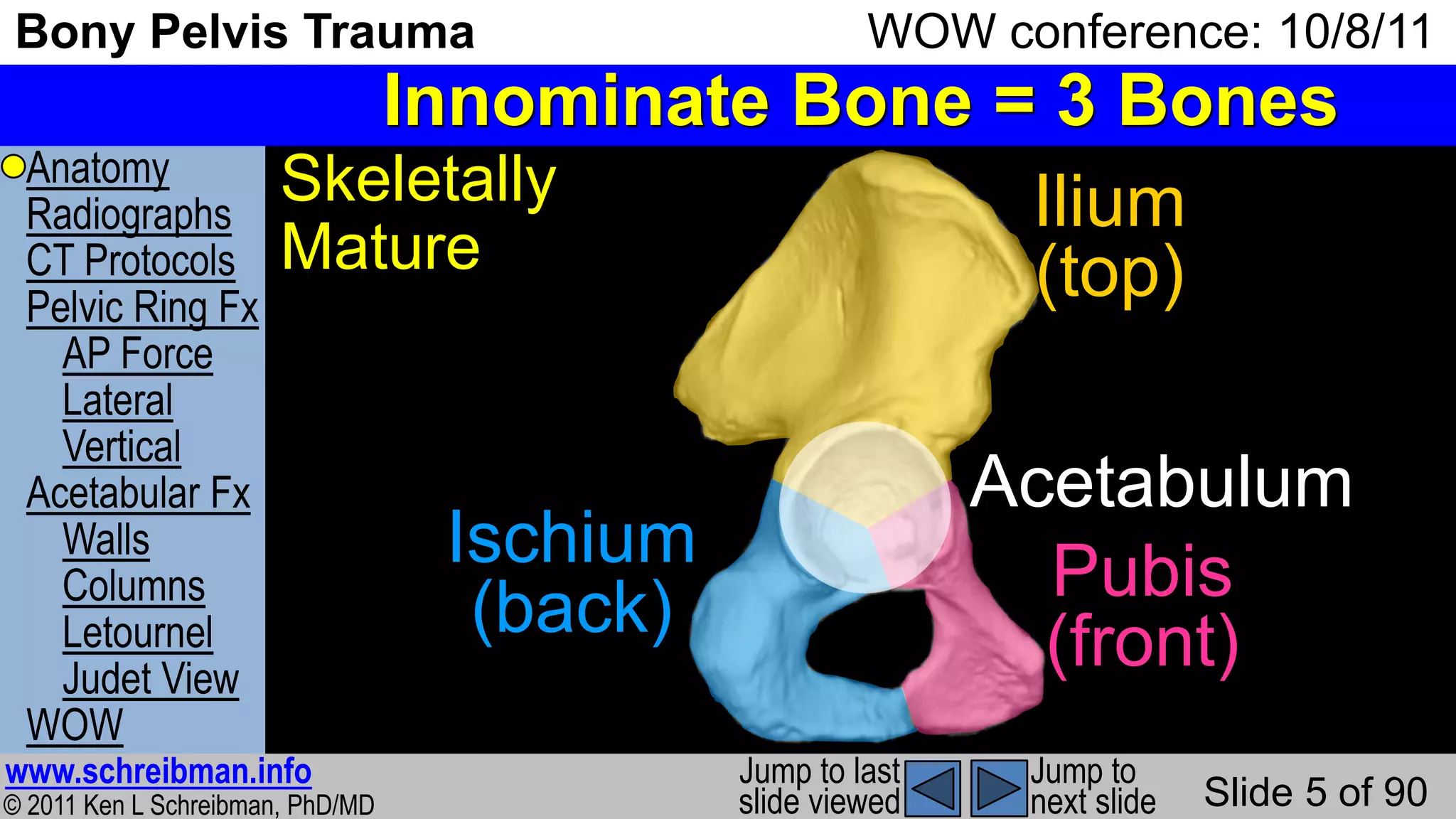 Bony Pelvis Trauma MSK Radiology Lecture | PPSX