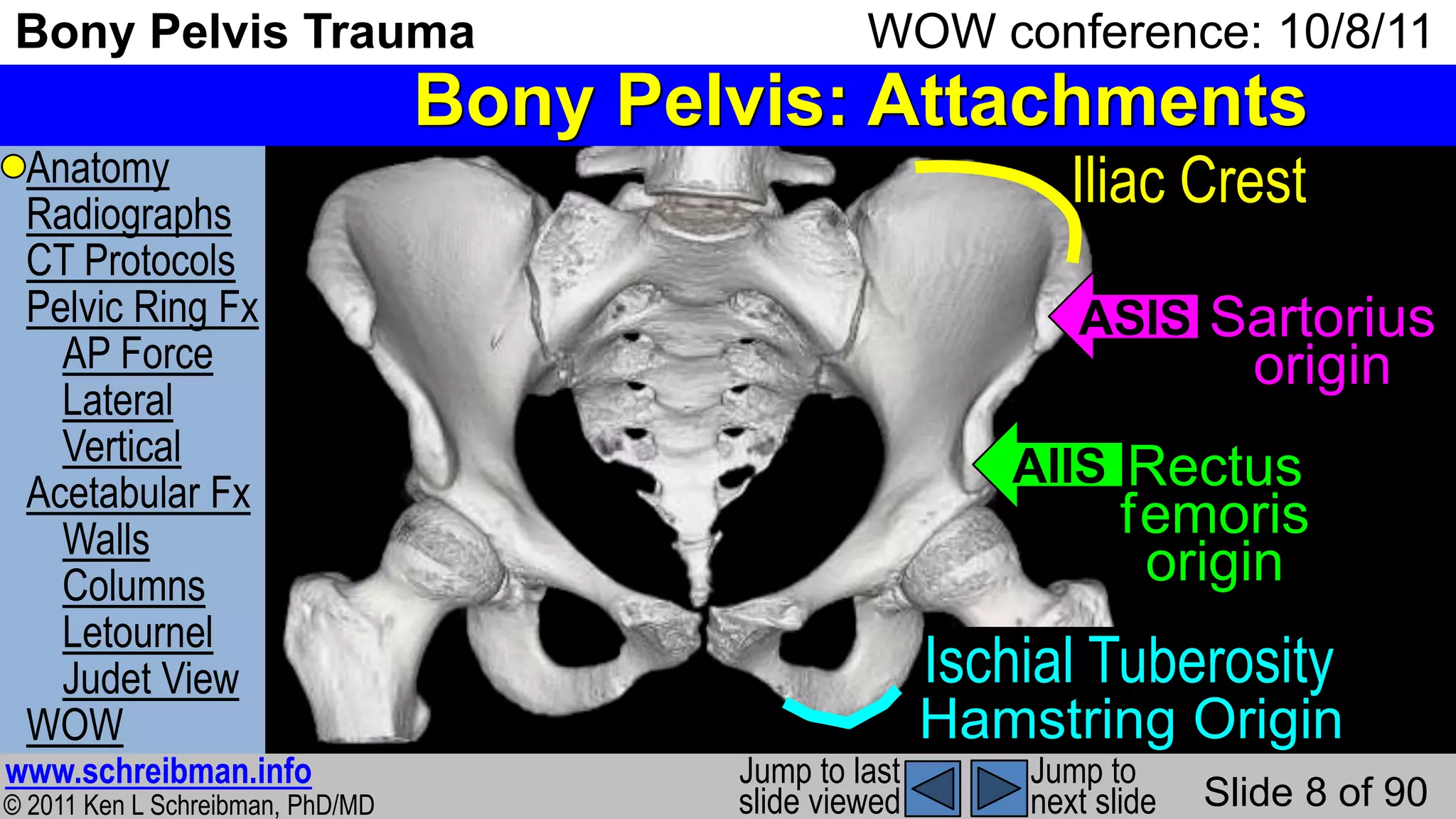 Bony Pelvis Trauma MSK Radiology Lecture | PPSX