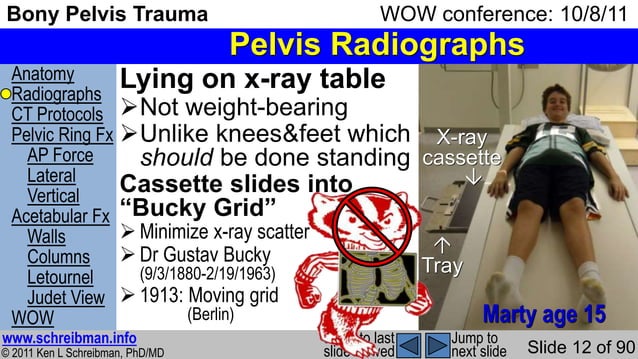 Bony Pelvis Trauma MSK Radiology Lecture | PPT