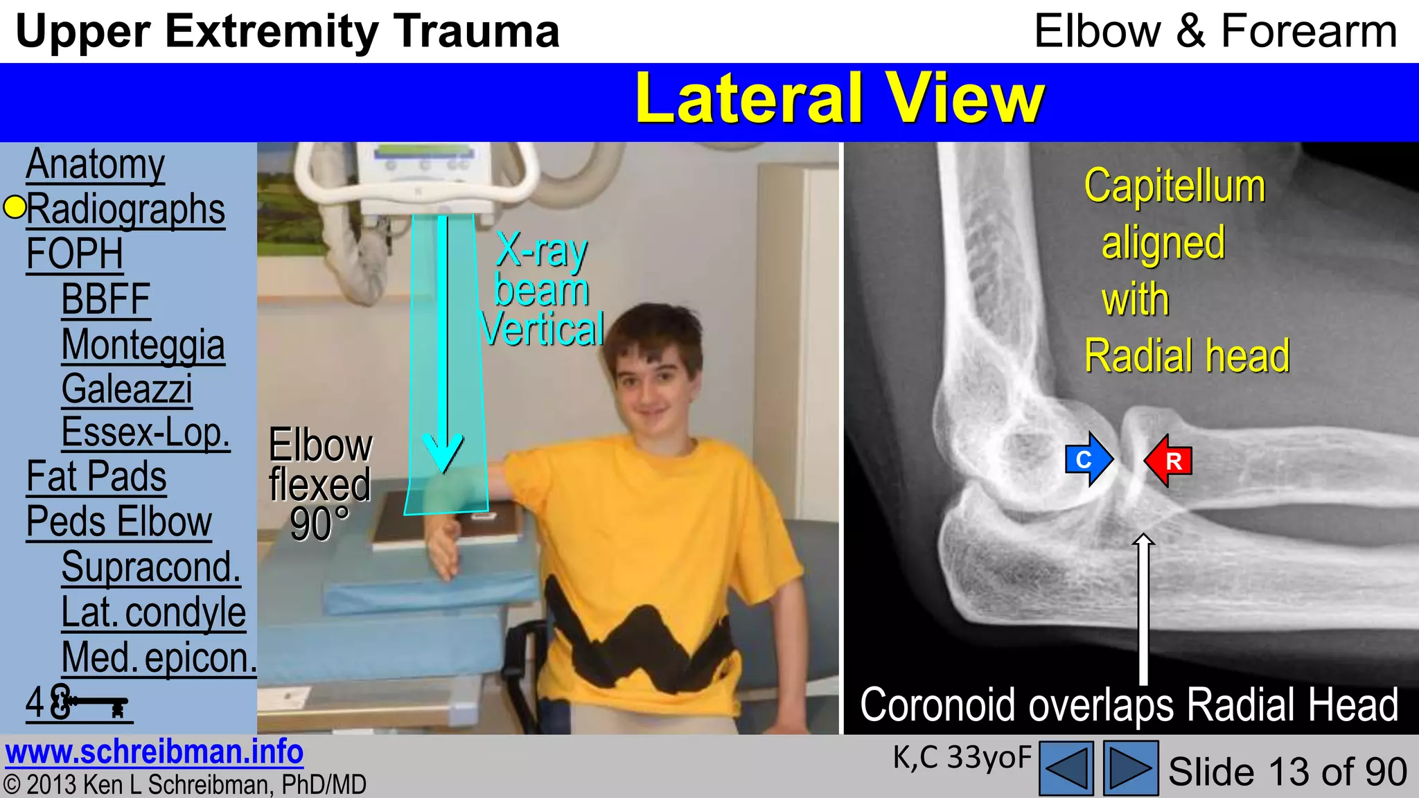 Upper Extremity Trauma Elbow & Forearm MSK Radiology Lecture | PPSX