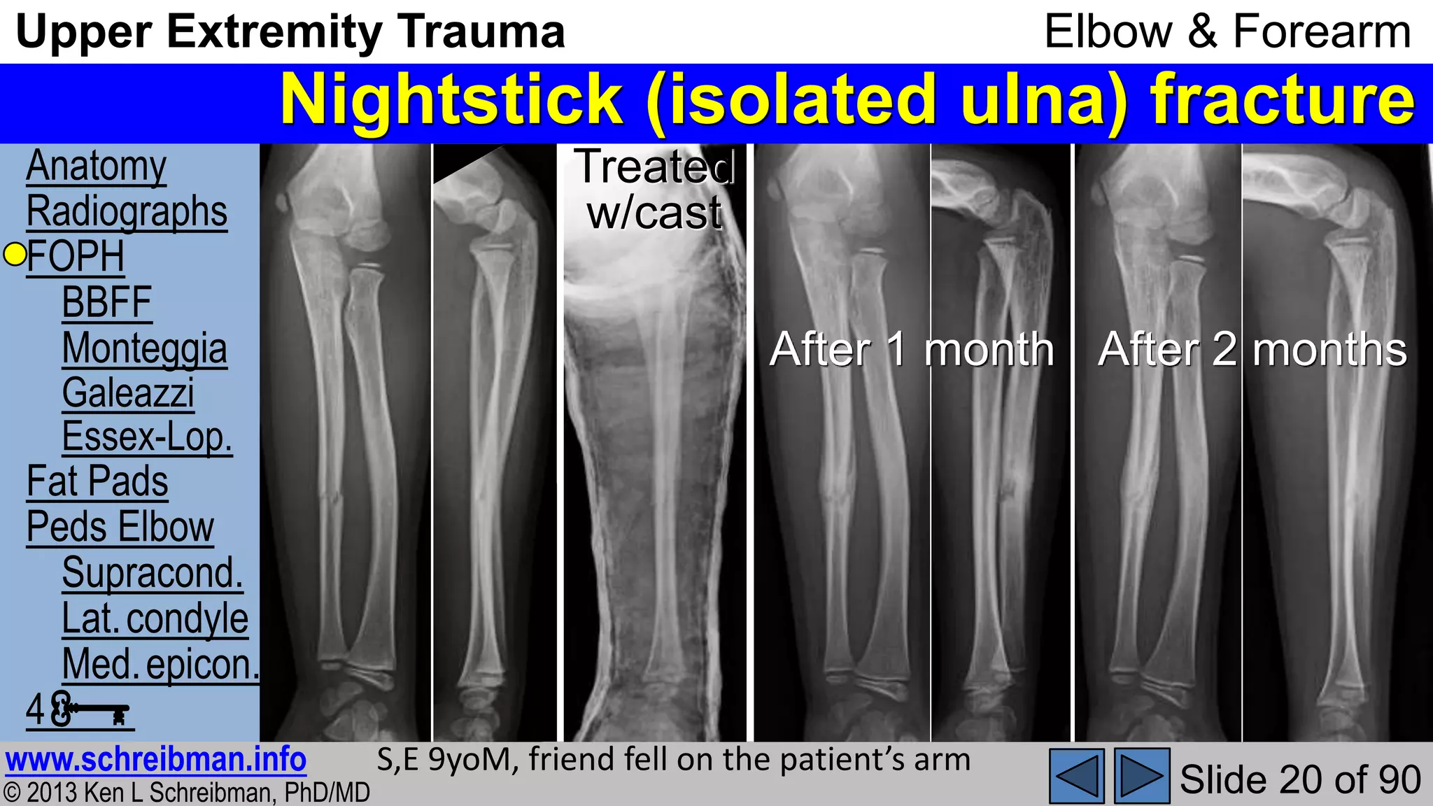 Upper Extremity Trauma Elbow & Forearm MSK Radiology Lecture | PPSX
