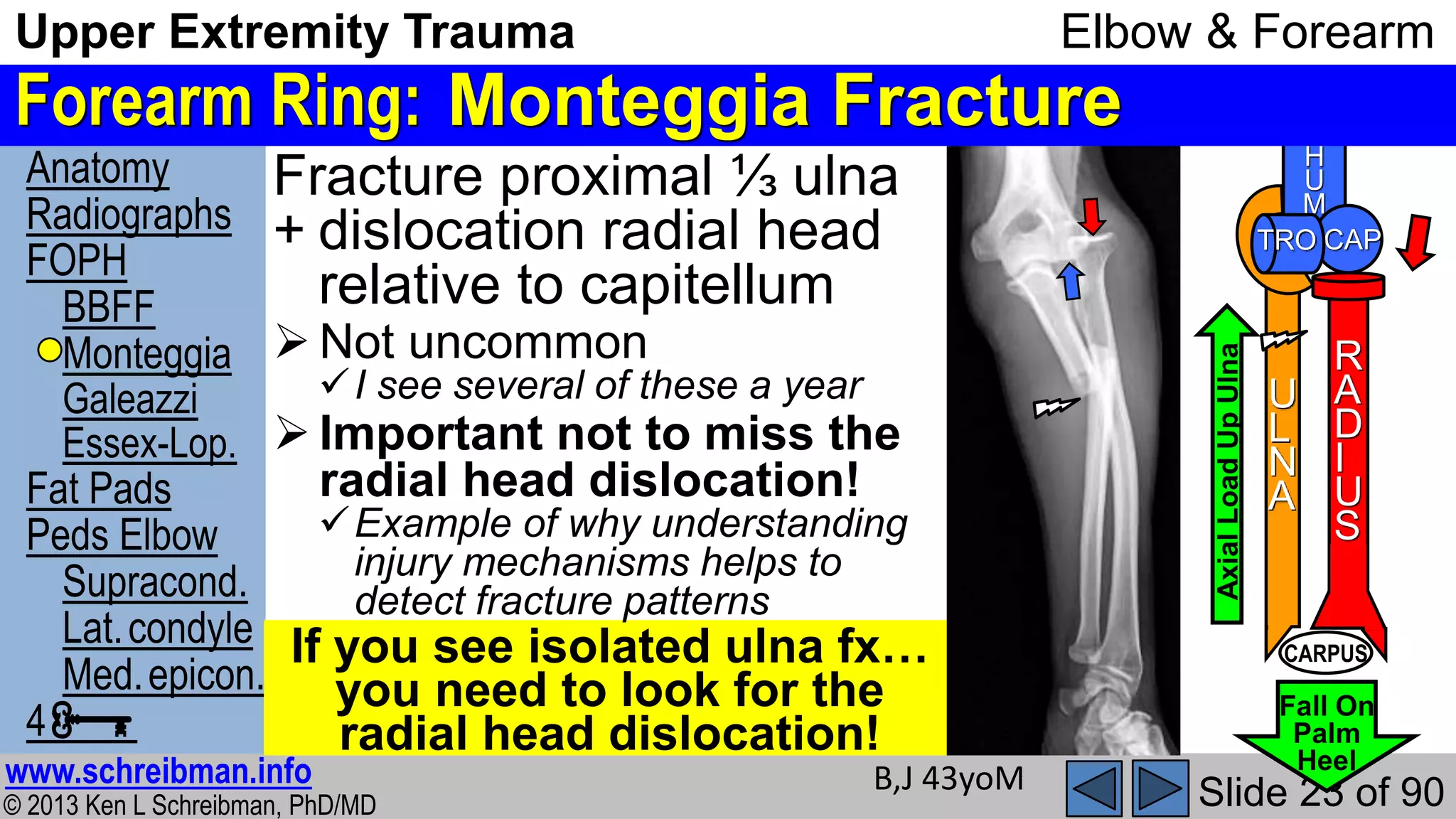 Upper Extremity Trauma Elbow & Forearm MSK Radiology Lecture | PPSX