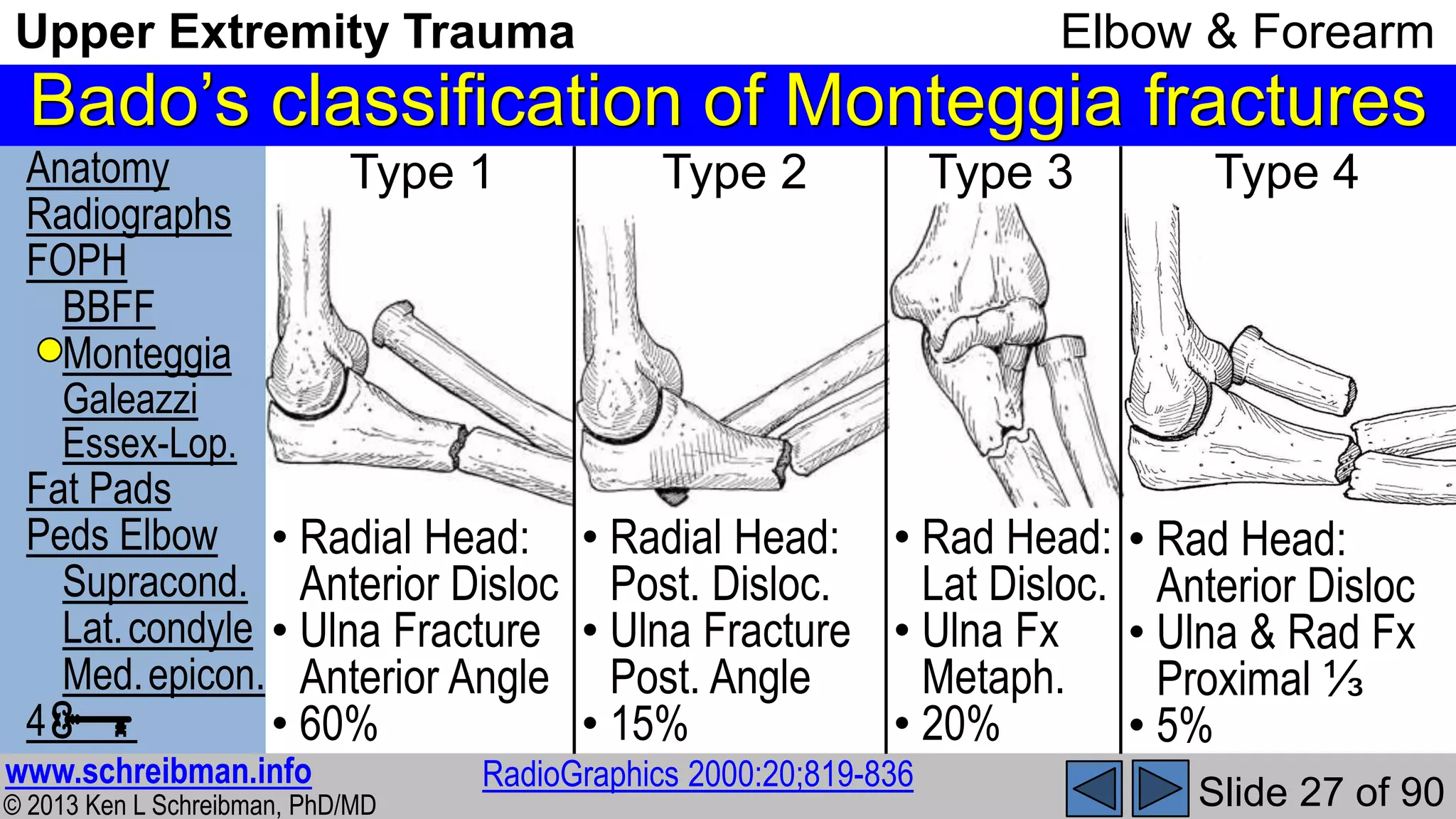 Upper Extremity Trauma Elbow & Forearm MSK Radiology Lecture | PPSX