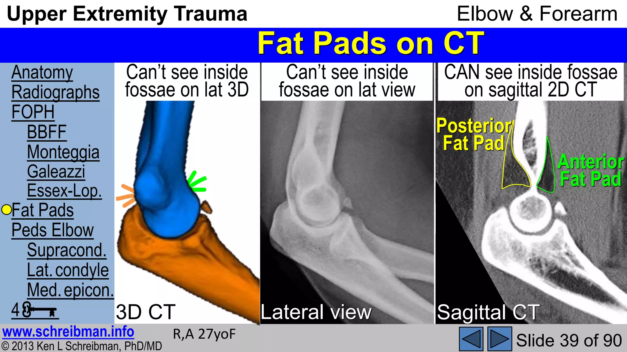 Upper Extremity Trauma Elbow & Forearm MSK Radiology Lecture | PPSX