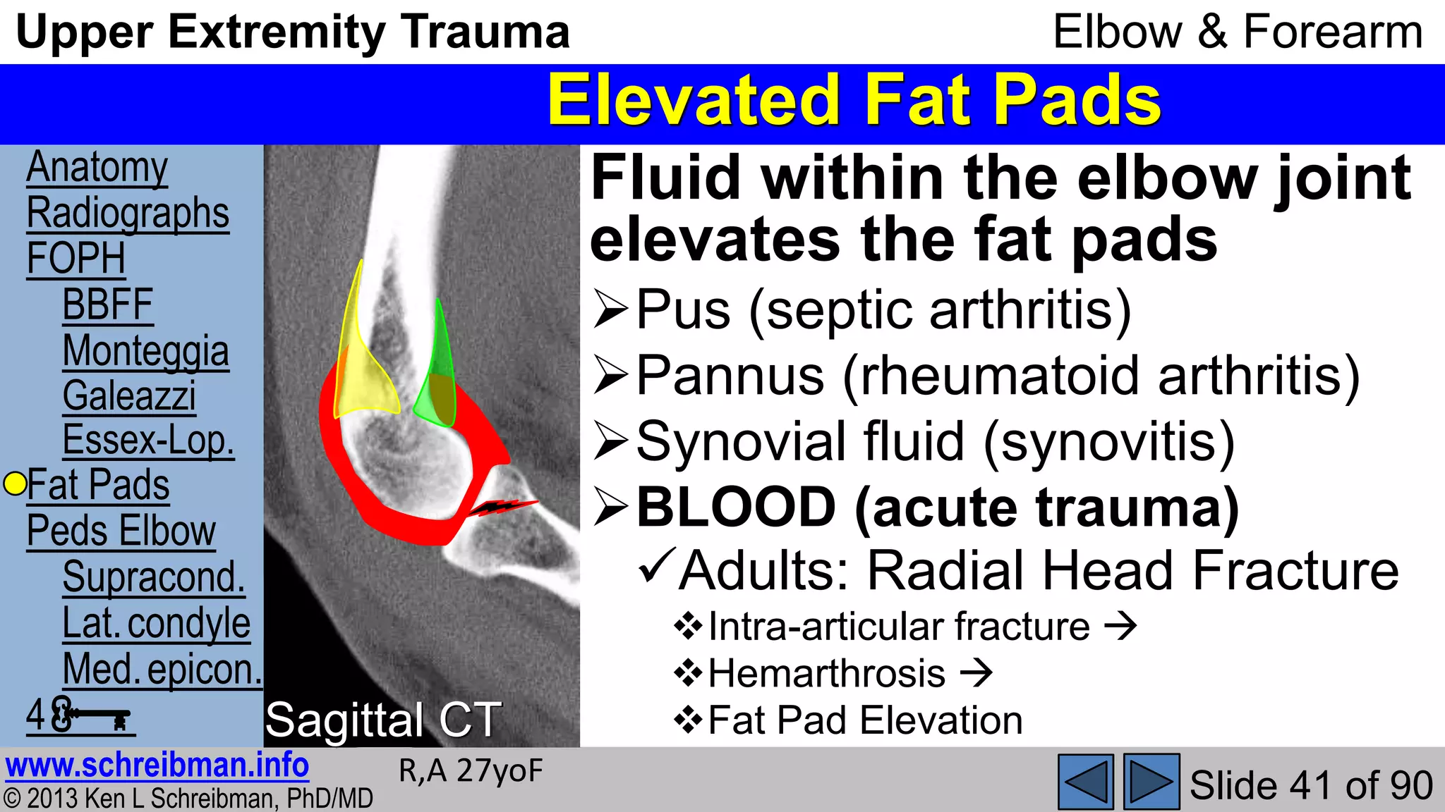 Upper Extremity Trauma Elbow & Forearm MSK Radiology Lecture | PPSX