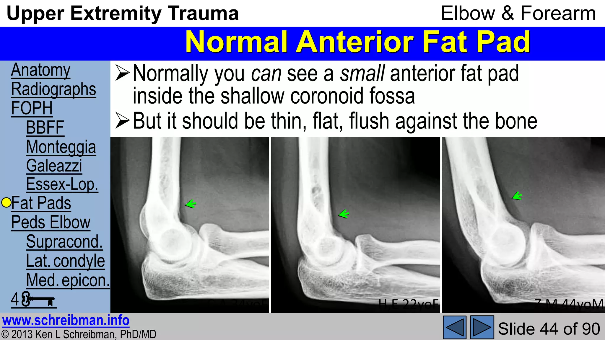 Upper Extremity Trauma Elbow & Forearm MSK Radiology Lecture | PPSX