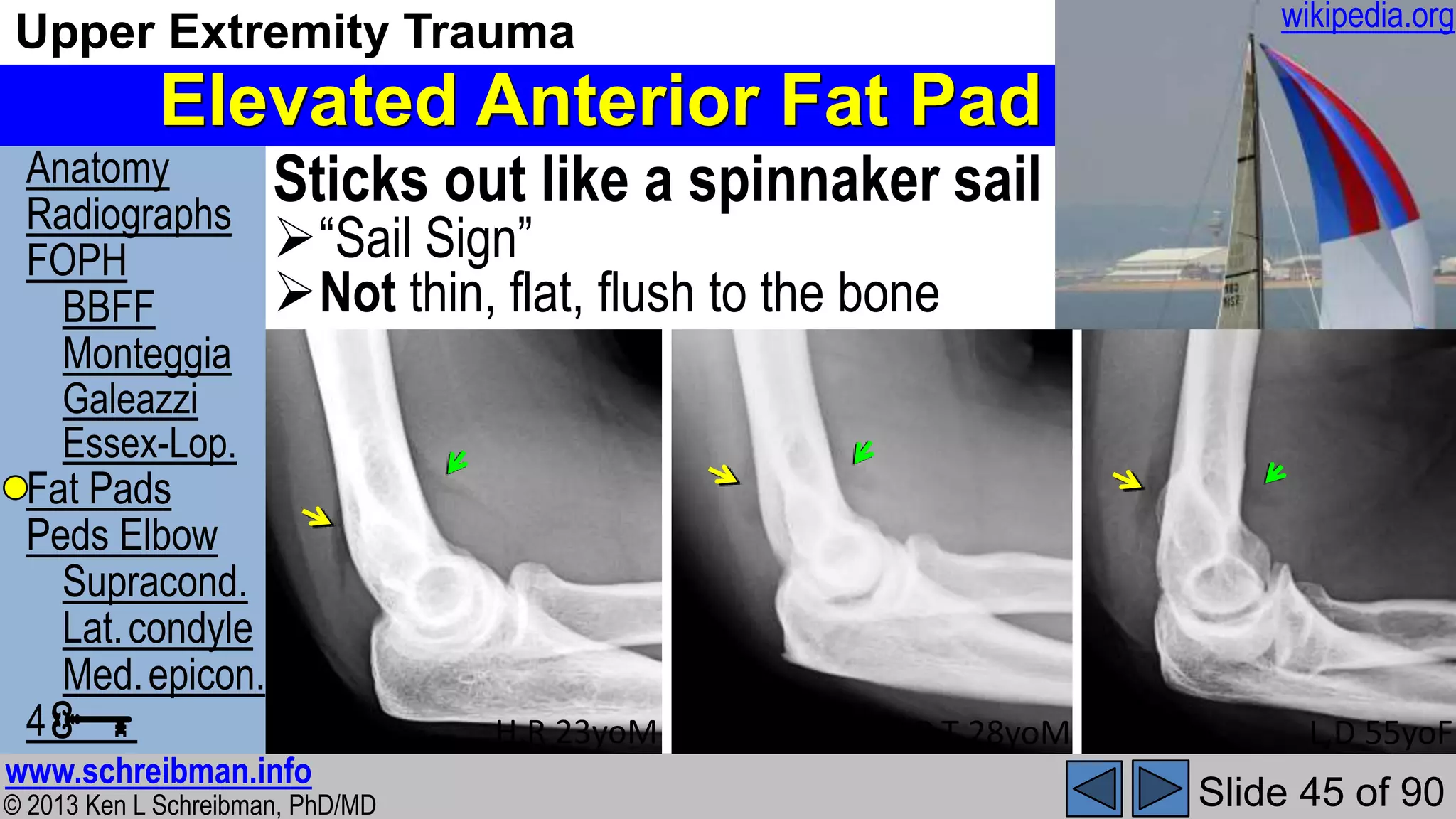 Upper Extremity Trauma Elbow & Forearm MSK Radiology Lecture | PPSX