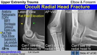 Upper Extremity Trauma Elbow & Forearm MSK Radiology Lecture | PPSX