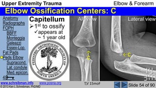 Upper Extremity Trauma Elbow & Forearm MSK Radiology Lecture | PPSX