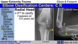 Upper Extremity Trauma Elbow & Forearm MSK Radiology Lecture | PPSX