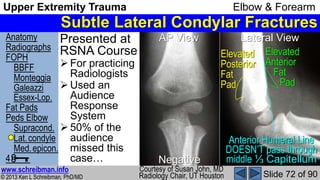 Upper Extremity Trauma Elbow & Forearm MSK Radiology Lecture | PPSX
