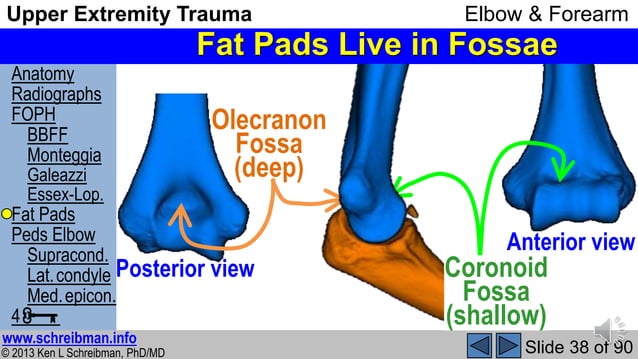 Upper Extremity Trauma Elbow & Forearm MSK Radiology Lecture N | PPT