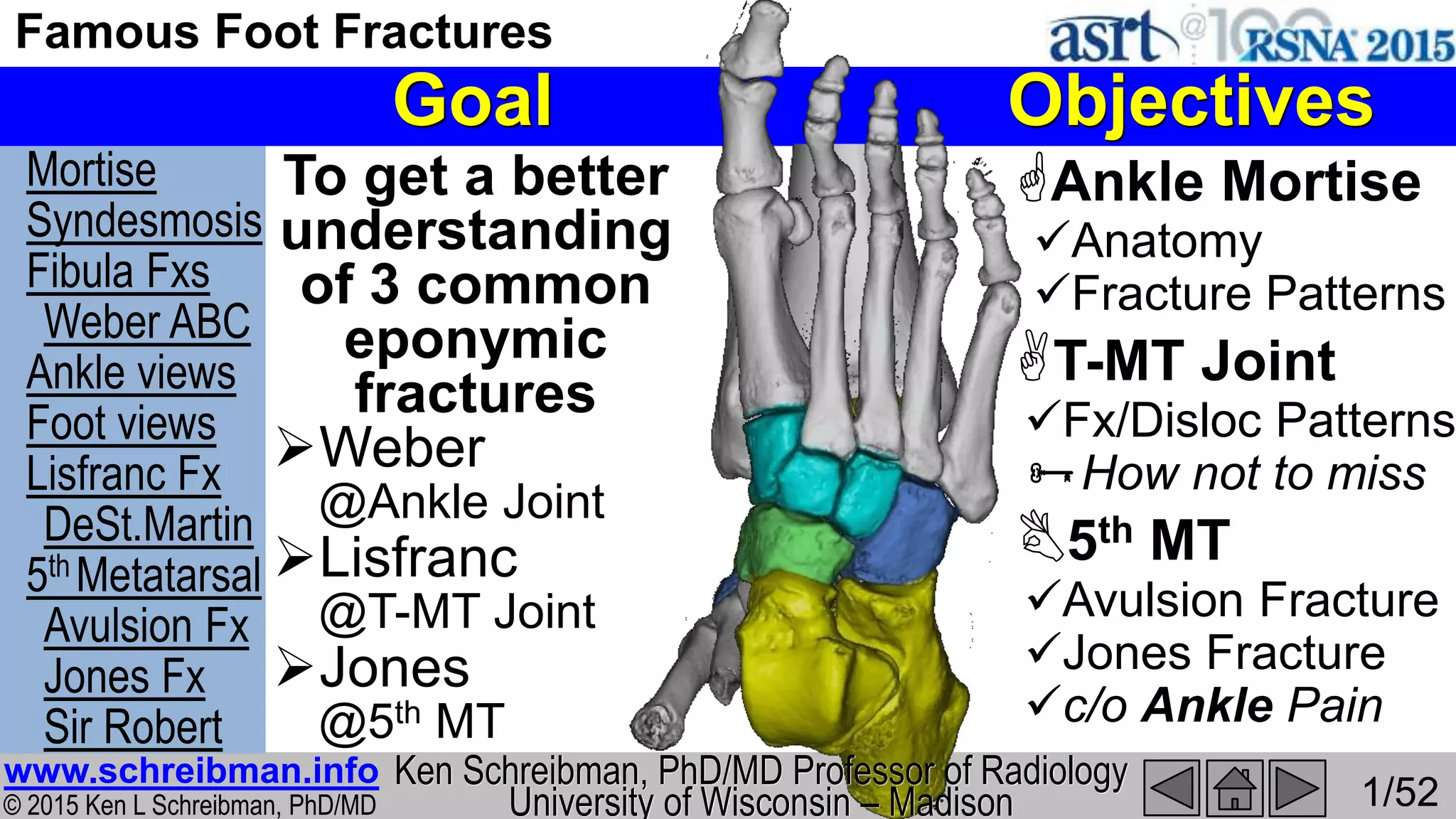 Famous foot fractures MSK Radiology Lecture | PPSX