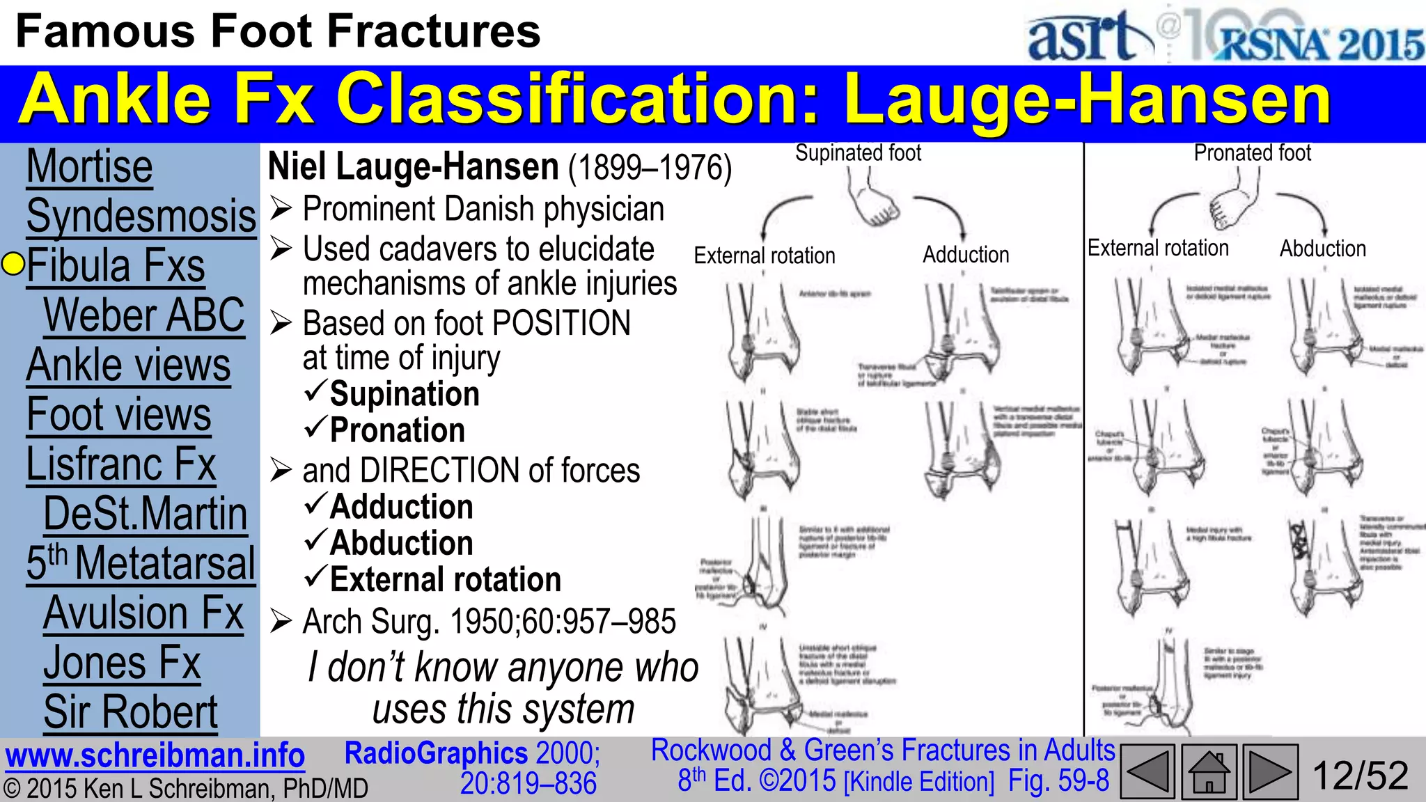 Famous foot fractures MSK Radiology Lecture | PPT