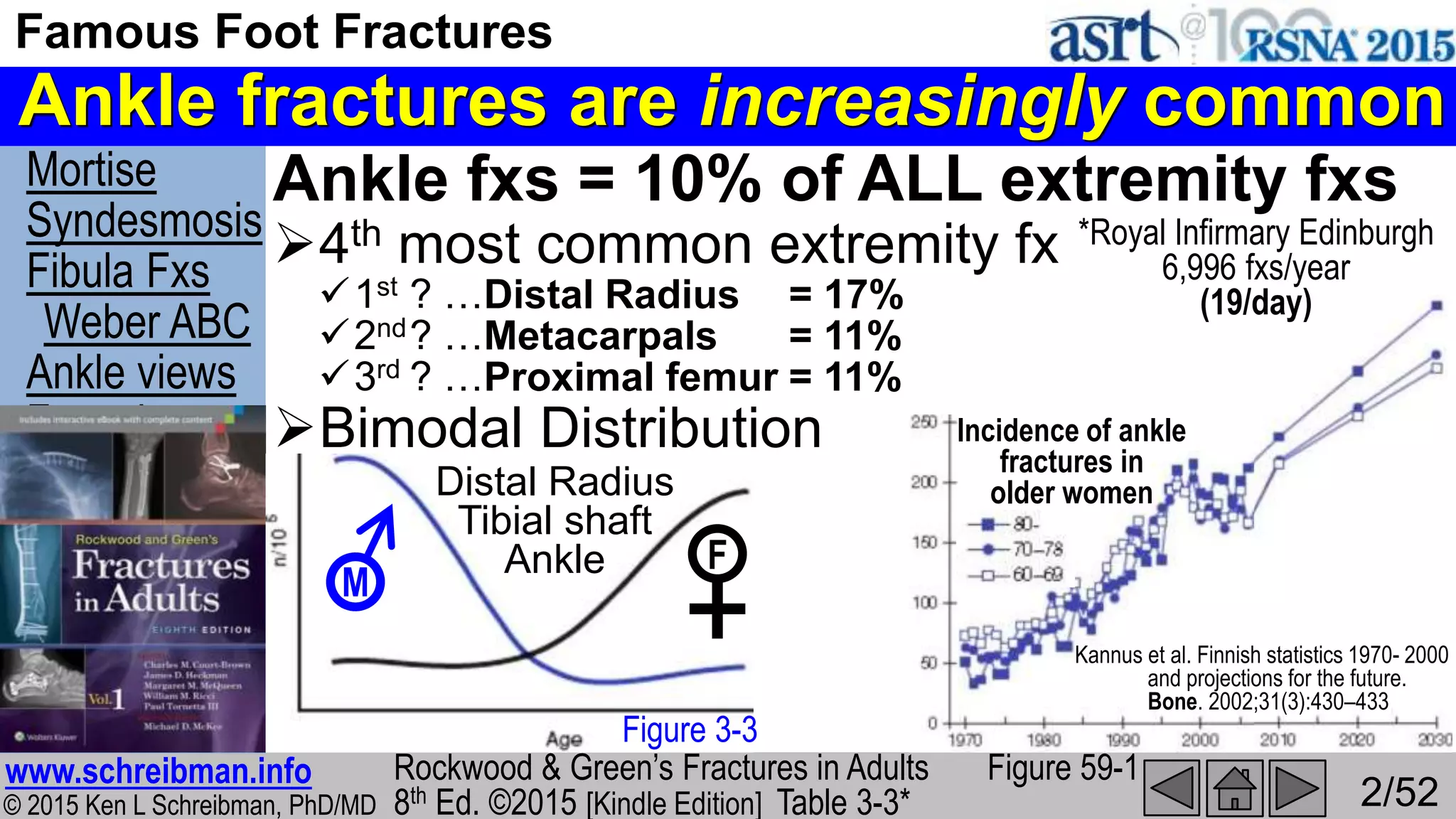 Famous foot fractures MSK Radiology Lecture | PPT