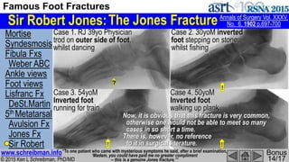 Famous foot fractures MSK Radiology Lecture | PPSX
