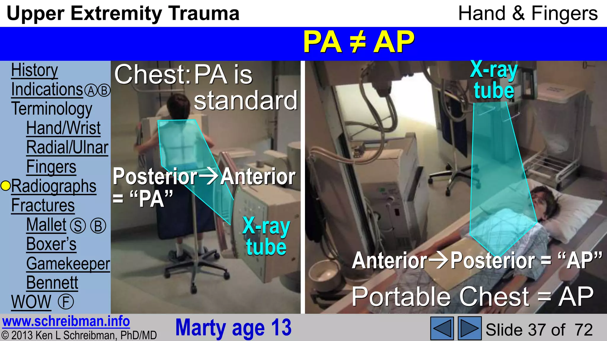 Upper Extremity Trauma MSK Radiology Lecture | PPT