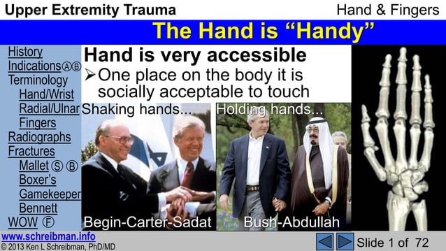 Upper Extremity Trauma MSK Radiology Lecture | PPT