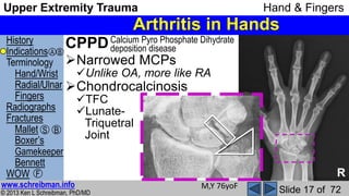 Upper Extremity Trauma MSK Radiology Lecture | PPSX