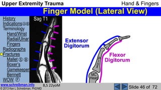 Upper Extremity Trauma MSK Radiology Lecture | PPSX