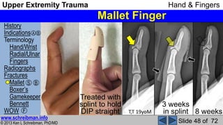 Upper Extremity Trauma MSK Radiology Lecture | PPSX