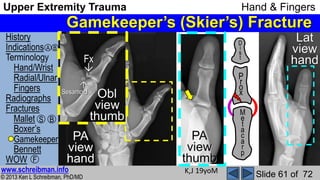 Upper Extremity Trauma MSK Radiology Lecture | PPSX
