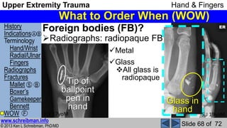 Upper Extremity Trauma MSK Radiology Lecture | PPSX