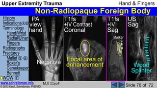 Upper Extremity Trauma MSK Radiology Lecture | PPSX