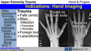 Upper Extremity Trauma MSK Radiology Lecture | PPSX