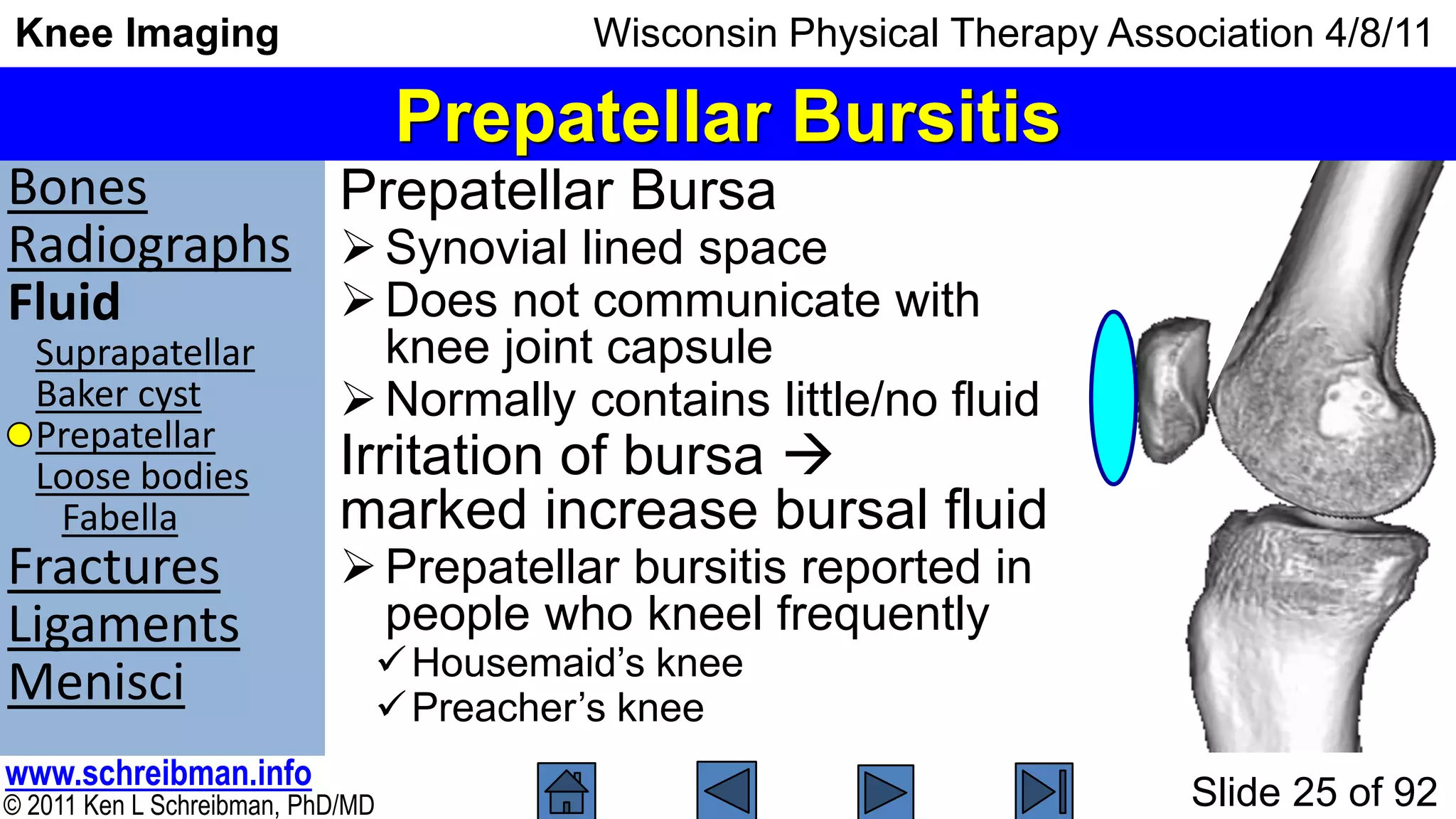 Knee Imaging MSK Radiology Lecture | PPSX | Death, Injury, or Military ...