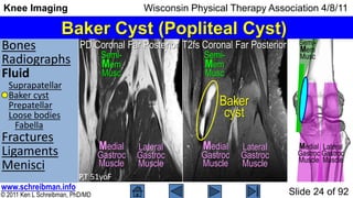 Knee Imaging MSK Radiology Lecture | PPSX