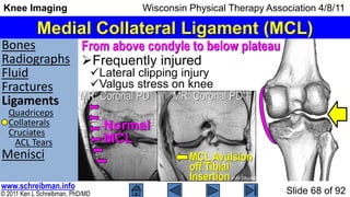 Knee Imaging MSK Radiology Lecture | PPSX