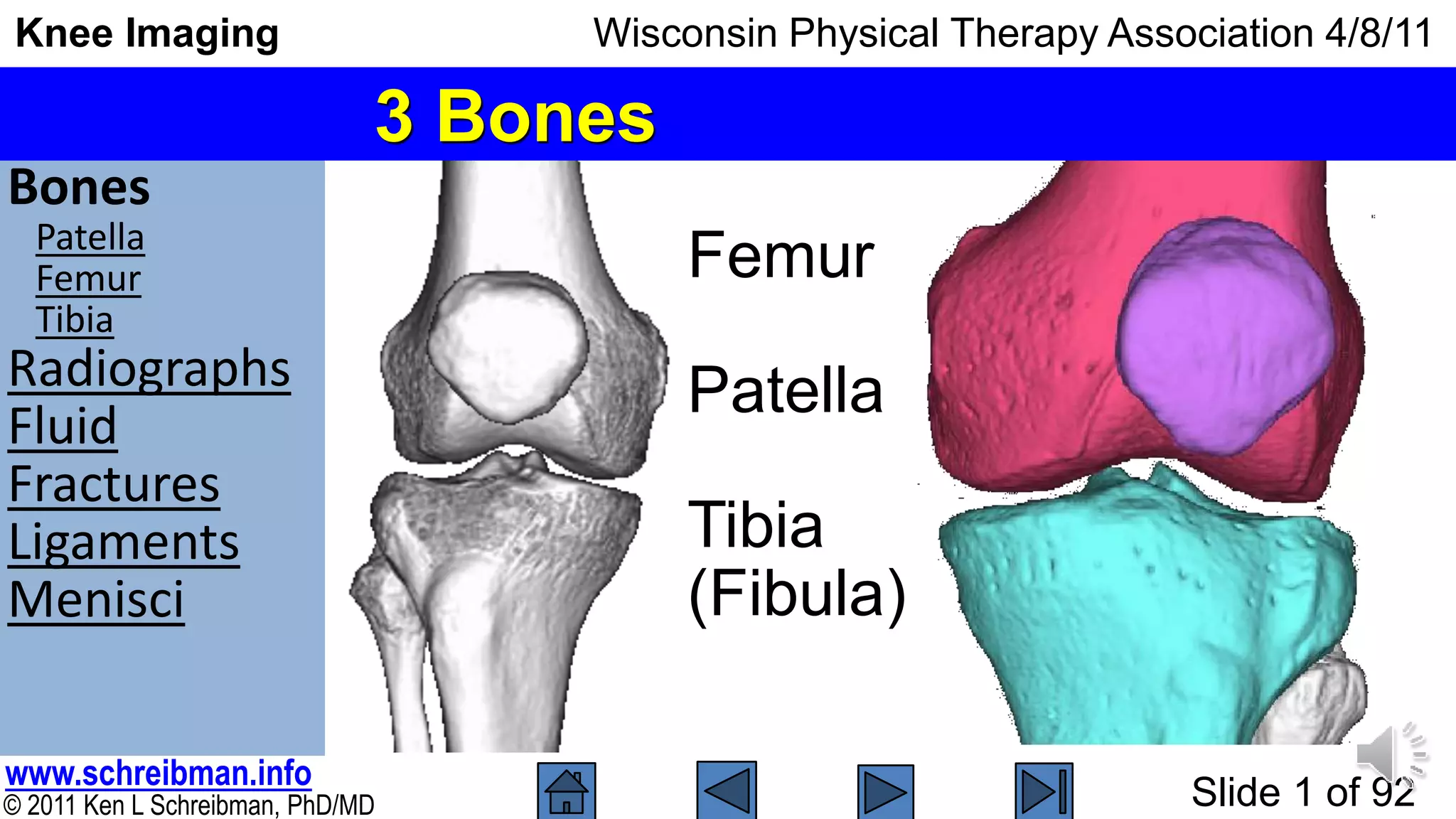 Knee Imaging narrated MSK Radiology Lecture | PPSX