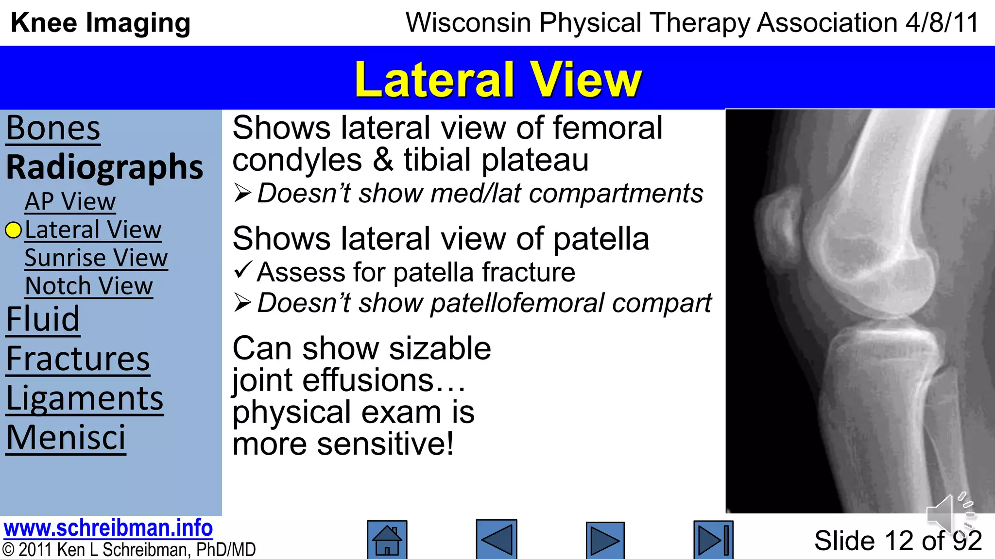Knee Imaging narrated MSK Radiology Lecture | PPT