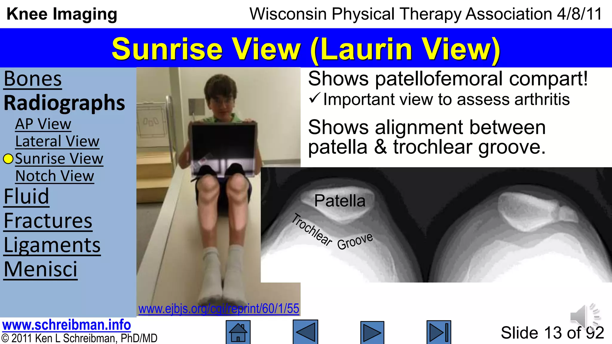 Knee Imaging narrated MSK Radiology Lecture | PPT
