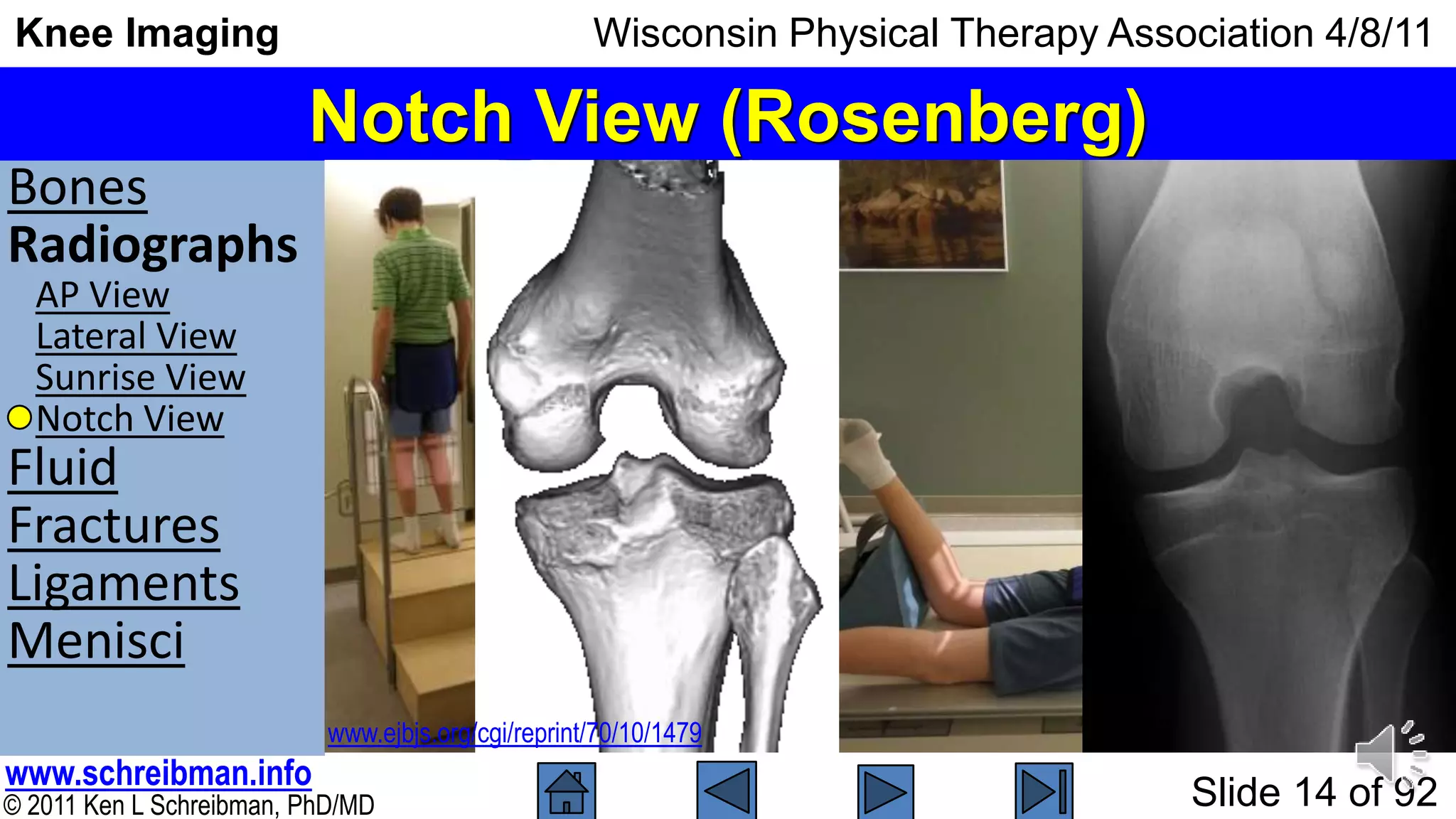 Knee Imaging narrated MSK Radiology Lecture | PPT