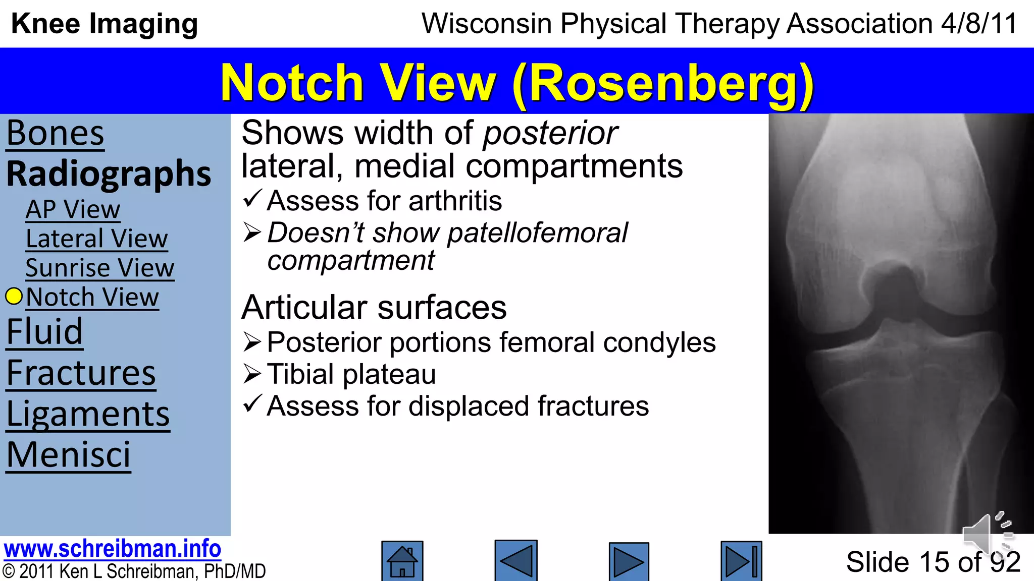 Knee Imaging narrated MSK Radiology Lecture | PPT