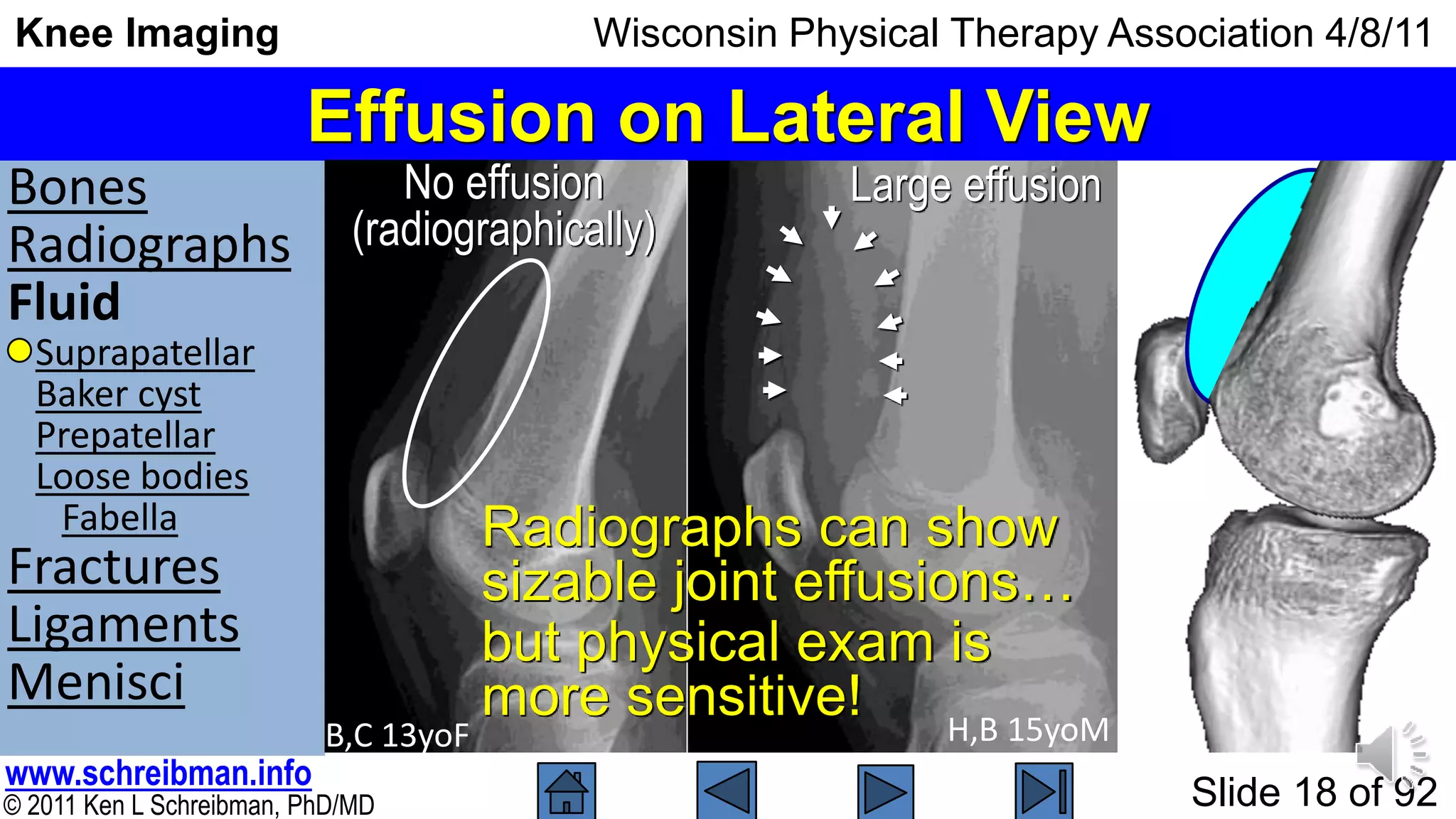 Knee Imaging narrated MSK Radiology Lecture | PPT