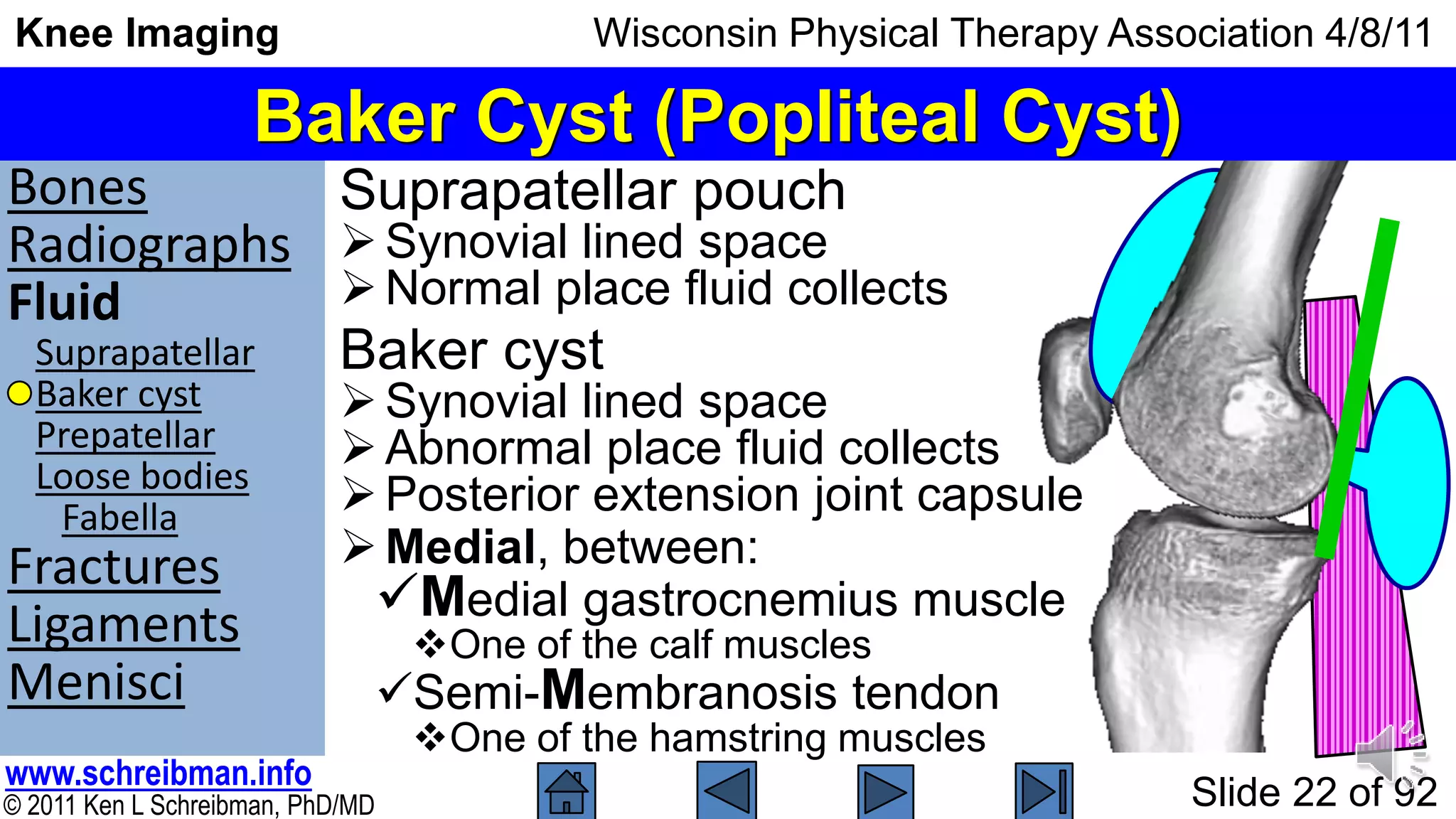 Knee Imaging narrated MSK Radiology Lecture | PPT
