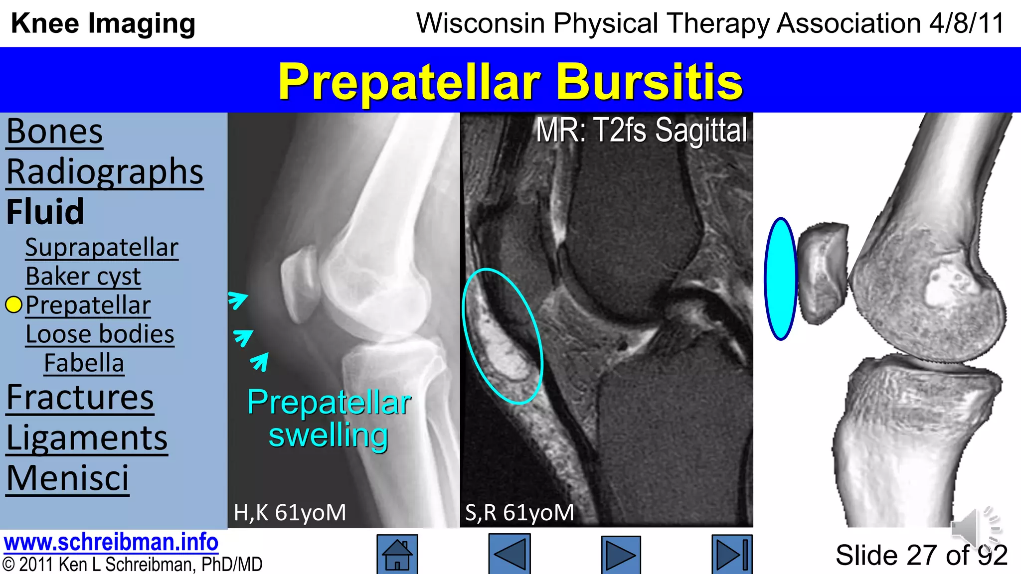 Knee Imaging narrated MSK Radiology Lecture | PPT